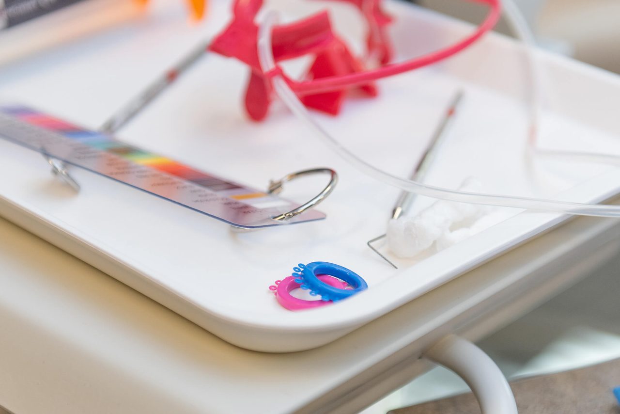 Types of Braces Wires for Orthodontic Treatment: Great Smiles